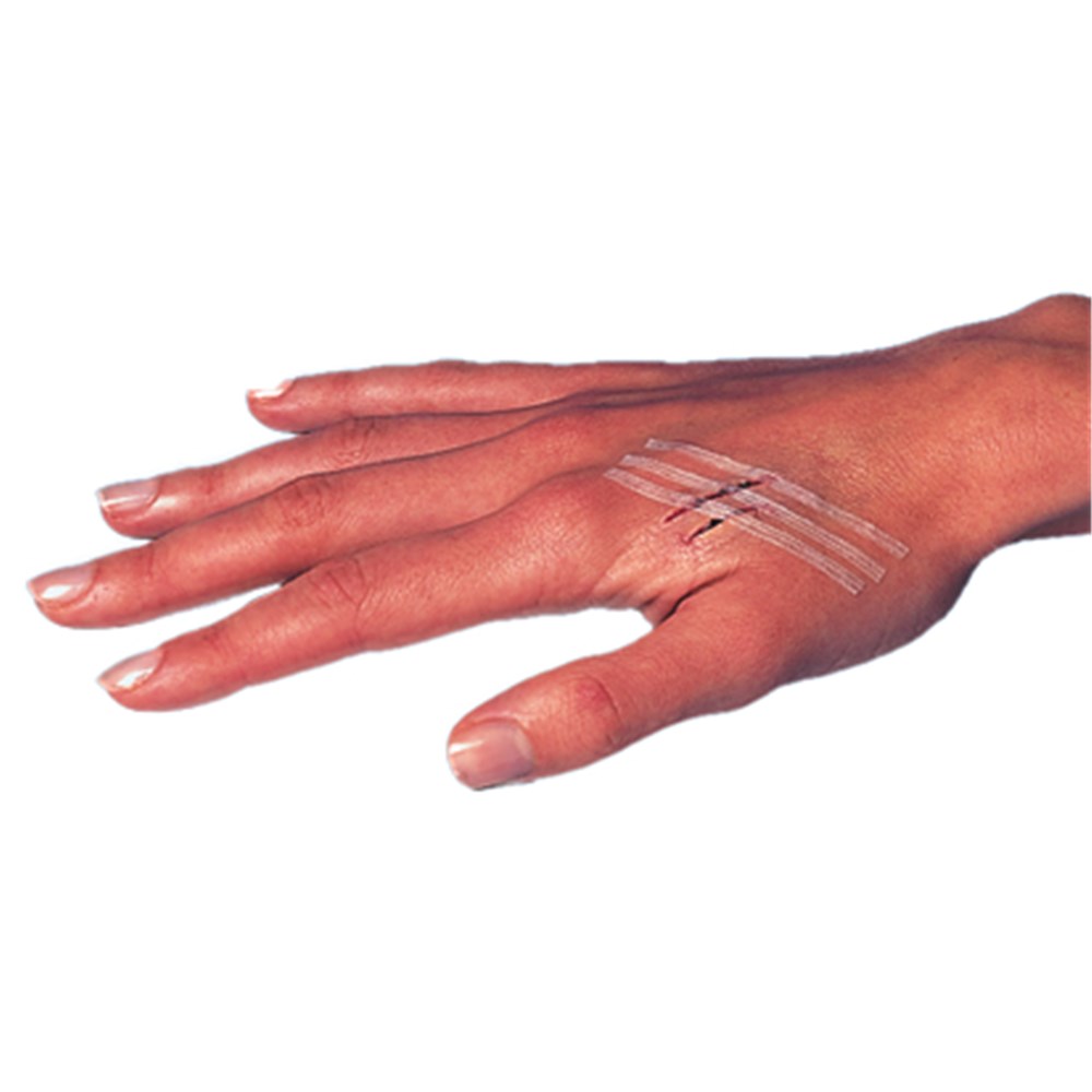Steri Strip Finger